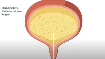 Luja™ Katheter der nächsten Generation für Männer - Coloplast Schweiz